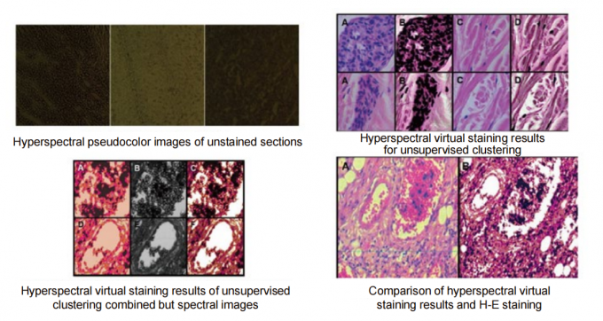 Detection Staining Microscopic Hyperspectral Imaging System With Lens ...